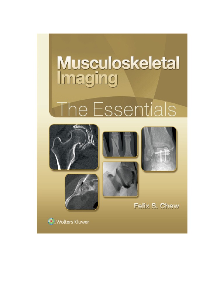 Musculoskeletal Imaging, The Essentials - Chew (2019) | PDF | Bone ...