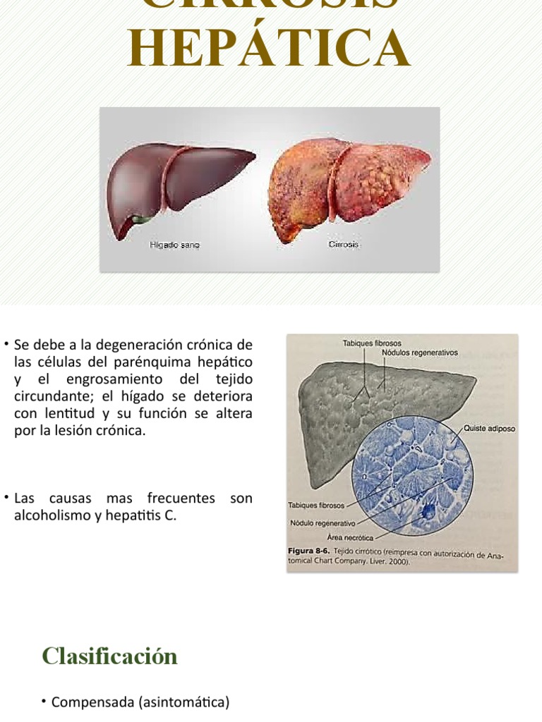 Cirrosis Hepática | PDF | Cirrosis | Alimentos