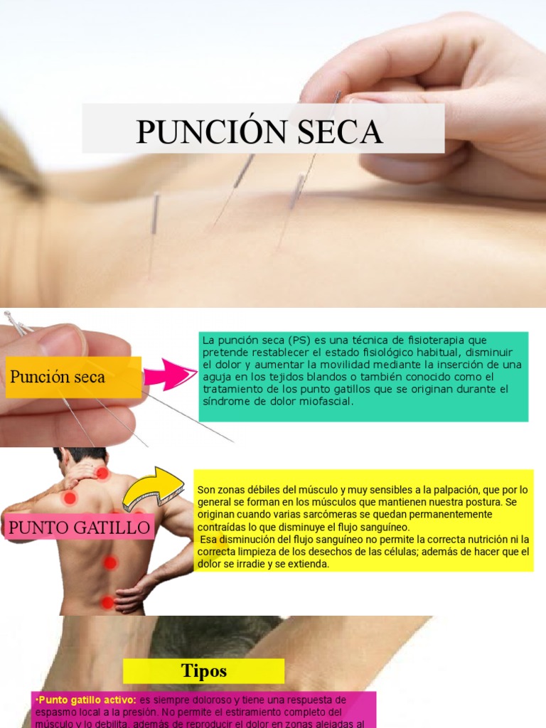 Punción Seca: Técnica y Beneficios | PDF | Dolor | Enfermedades y ...