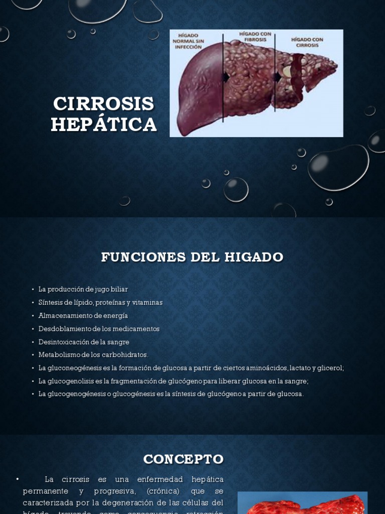 Cirrosis Hepatica | PDF | Cirrosis | Hígado