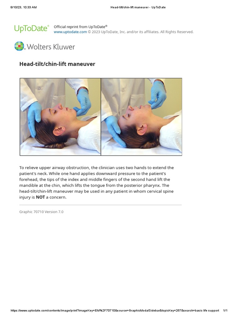 Head-Tilt - Chin-Lift Maneuver - UpToDate | PDF Head-Tilt - Chin-Lift Maneuver - UpToDate | PDF