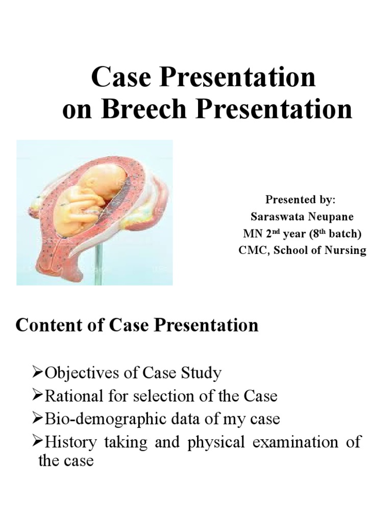 Breech Presentation | PDF