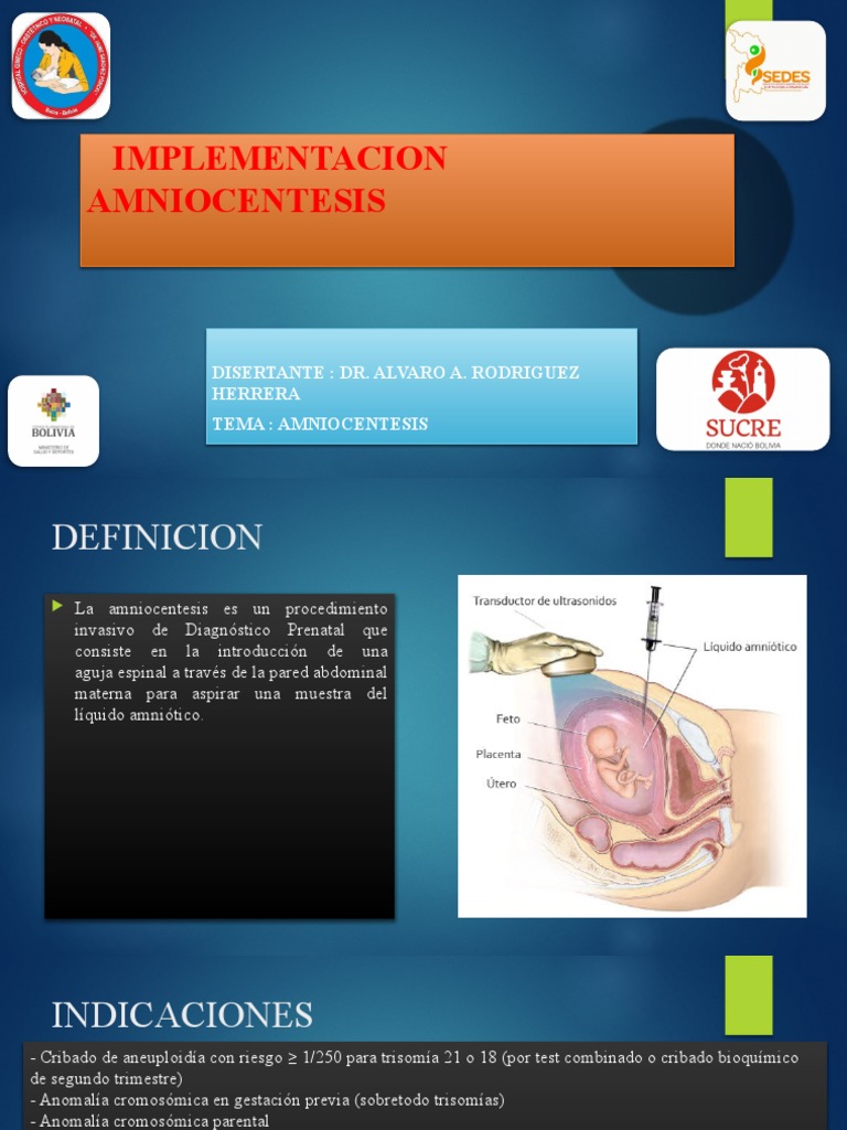 Amniocentesis | PDF