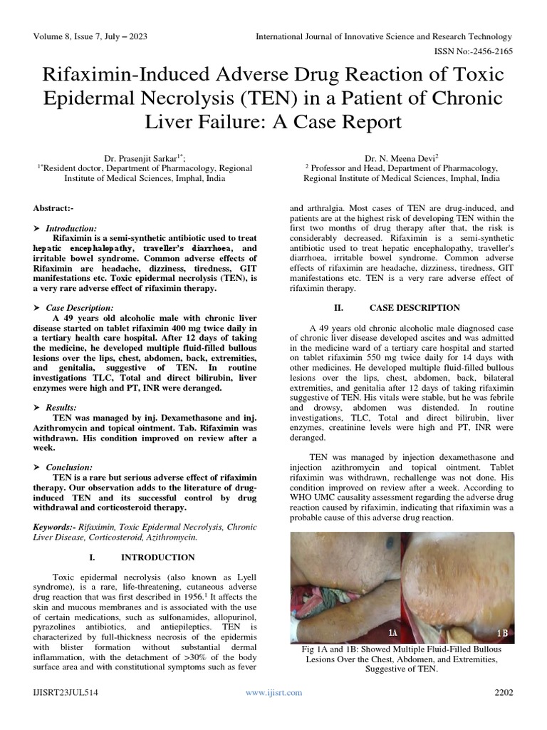 Rifaximin-Induced Toxic Epidermal Necrolysis | PDF | Wellness | Science ...