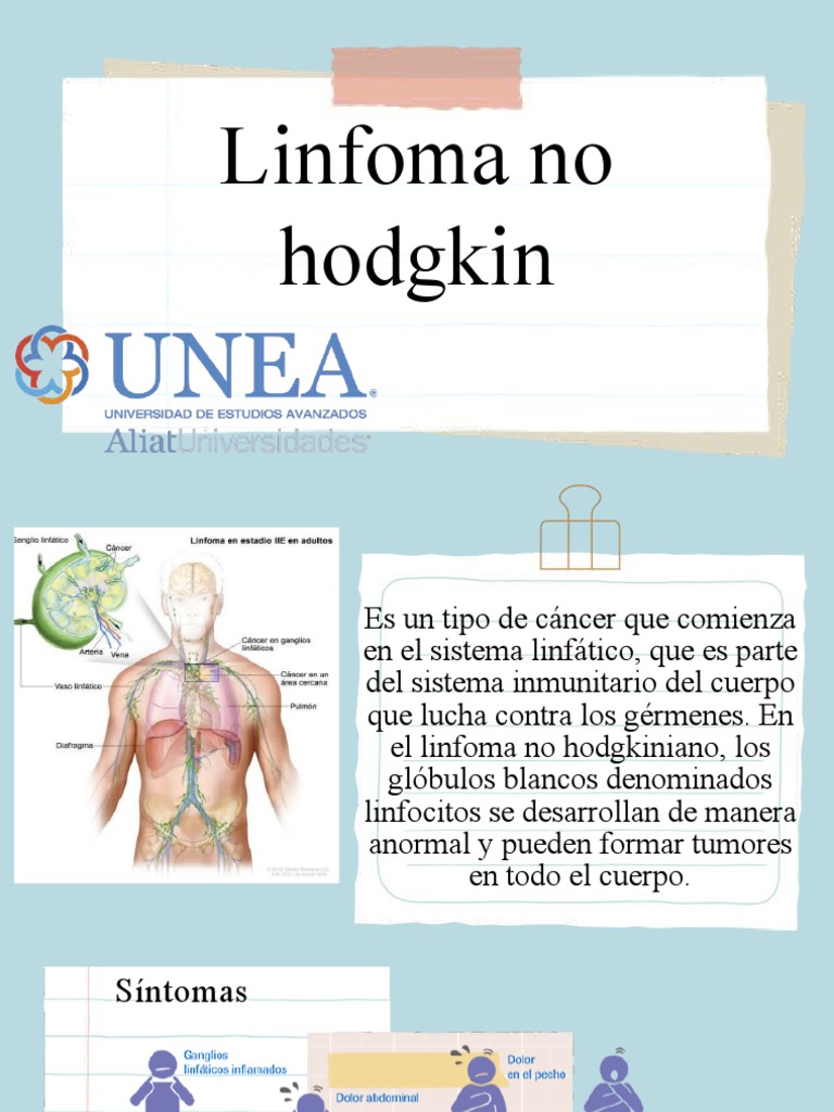 Linfoma No Hodgkin | PDF