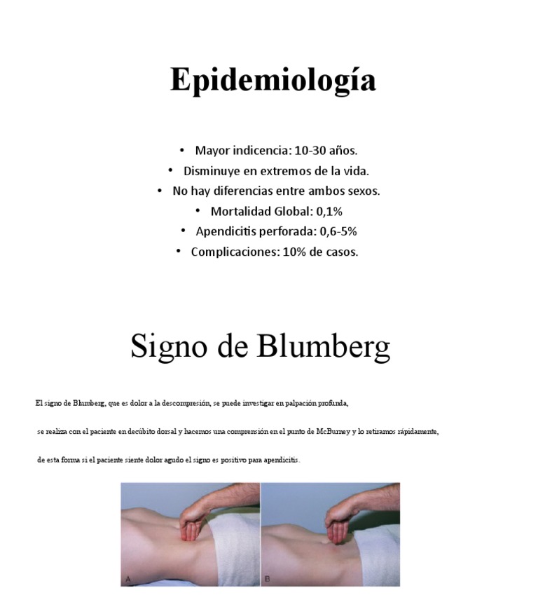 Epidemiología - Signo de Blumberg - Matheus | PDF