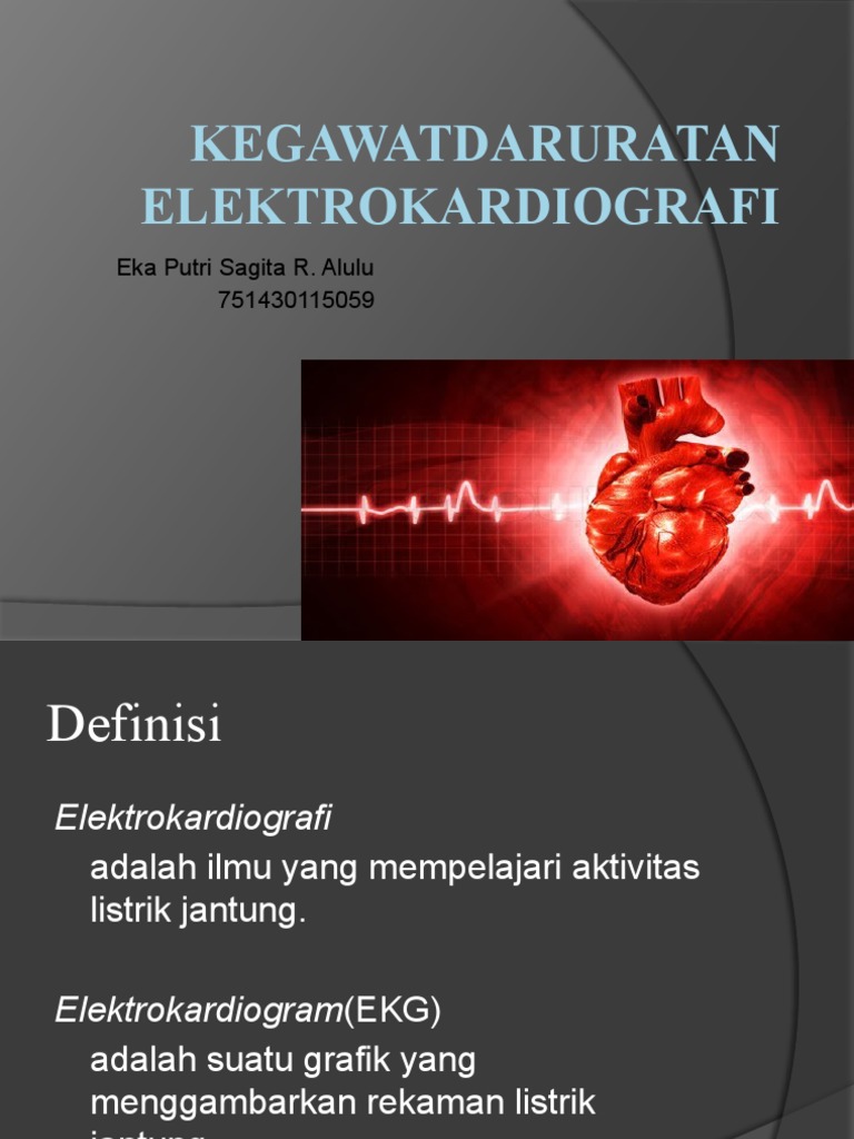 EKG Eka | PDF
