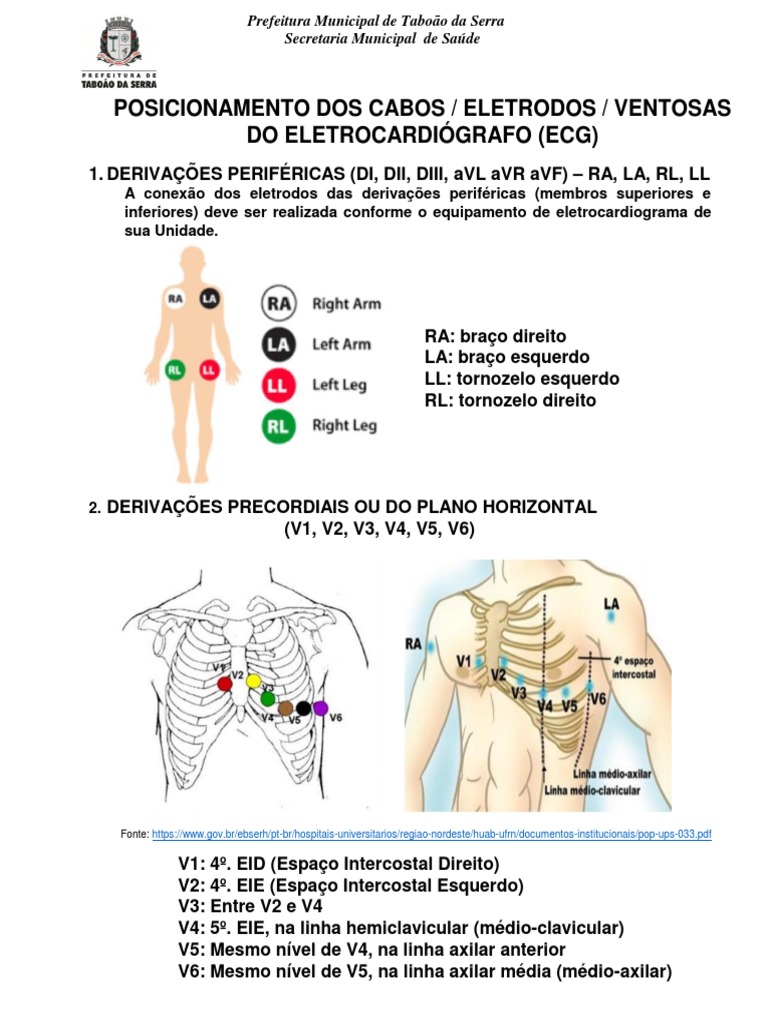 Posicionamento dos Eletrodos no ECG | PDF