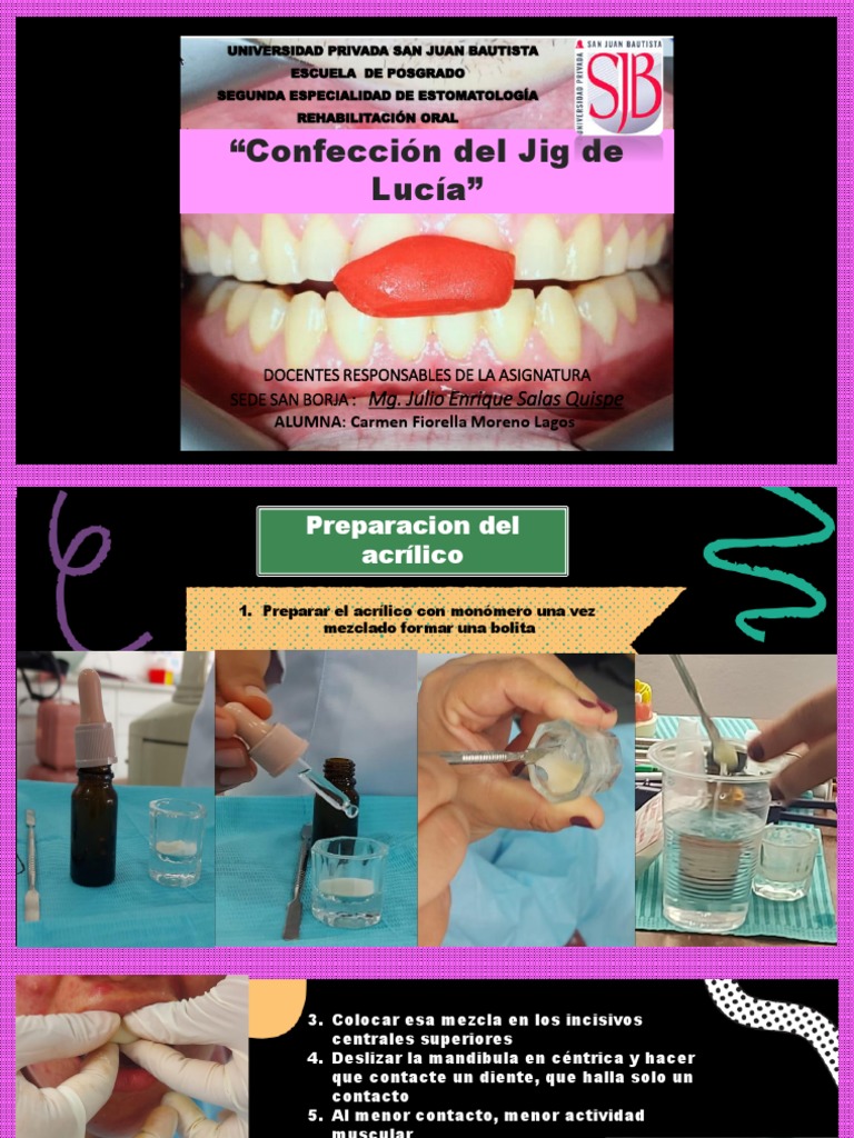 Confección del Jig de Lucía en Odontología | PDF | Salud y bienestar
