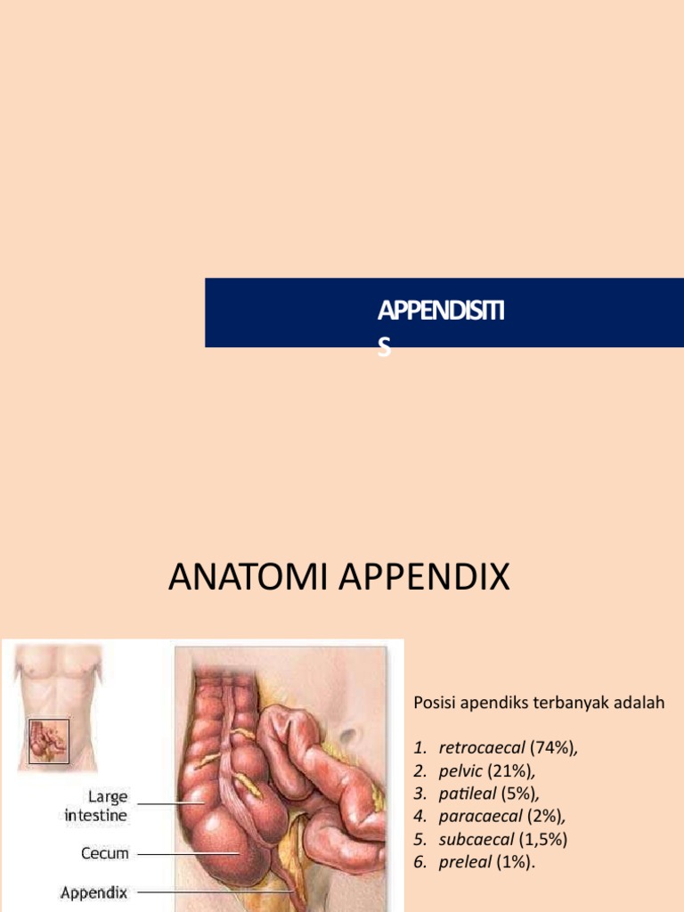 Appendicitis Dan Peritonitis | PDF