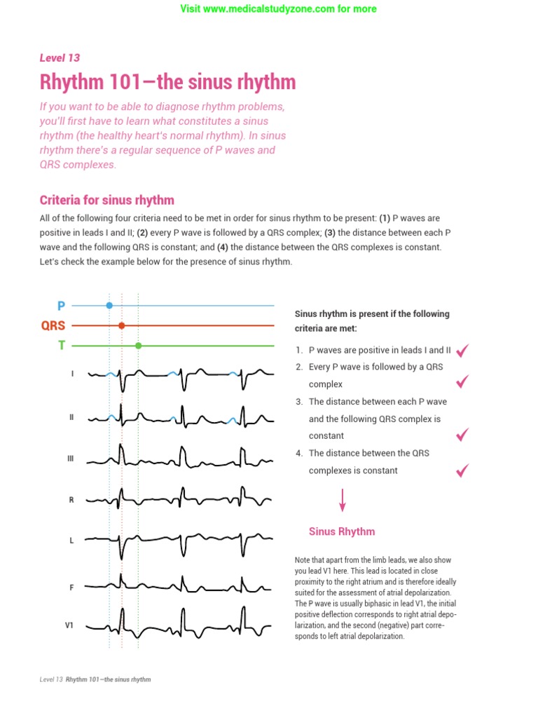 Rhythm 101-The Normal Rhythm - Fact Sheet | PDF | Electrocardiography ...