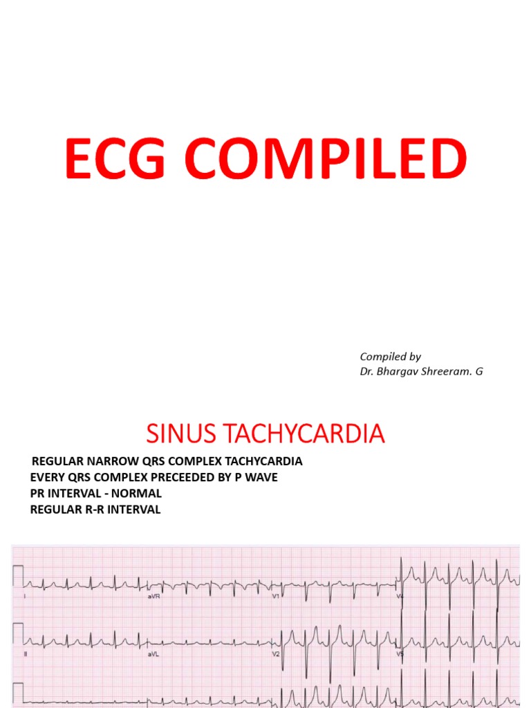 Ecg Compiled | PDF | Electrocardiography | Clinical Medicine