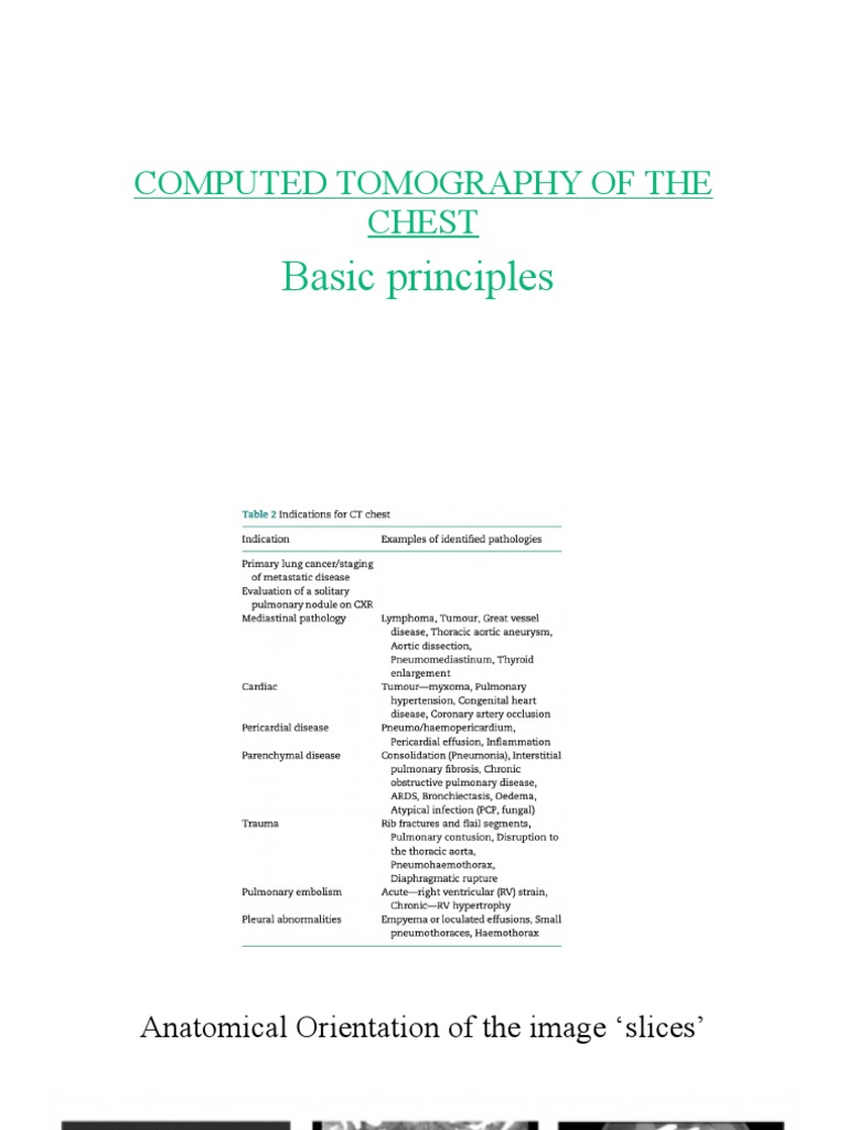 Chest Ct Scan Basic Principle Pdf
