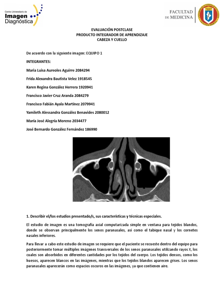 Sinusitis | PDF | Ct Scan | Epidemiología