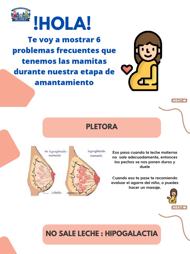 Dificultades en La Lactancia Materna | PDF Dificultades en La Lactancia Materna | PDF