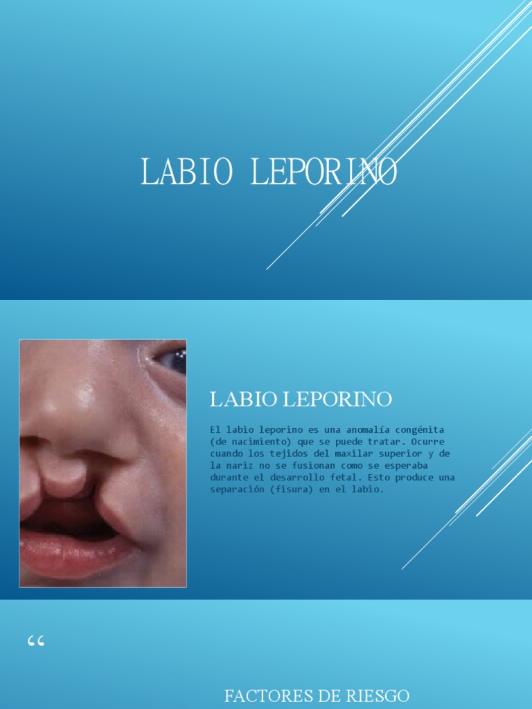 Labio Leporino | PDF | El embarazo | Anatomía humana