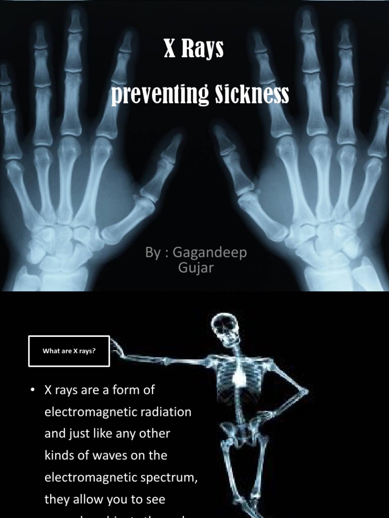 X Rays | PDF | X Ray | Applied And Interdisciplinary Physics