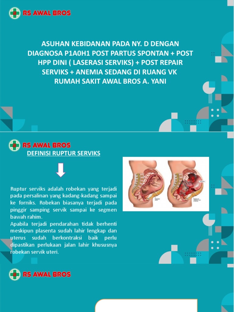 Rupture Serviks | PDF