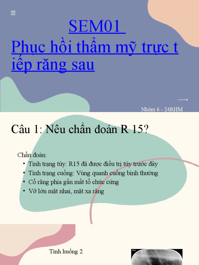 SEM01 Phục hồi thẩm mỹ trực t iếp răng sau | PDF