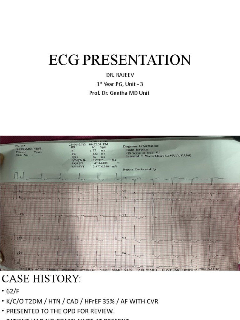 Ecg Presentation | PDF