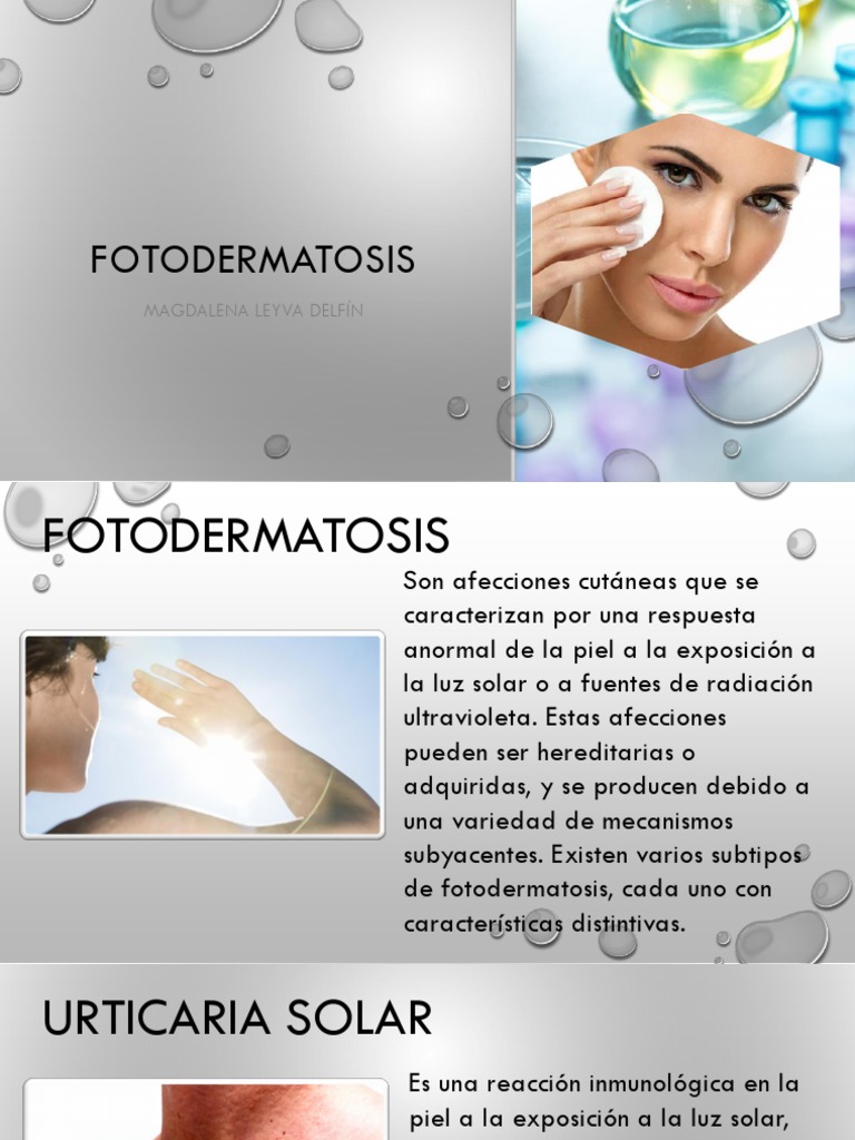 FOTODERMATOSIS | PDF | Medicina CLINICA | Especialidades Medicas
