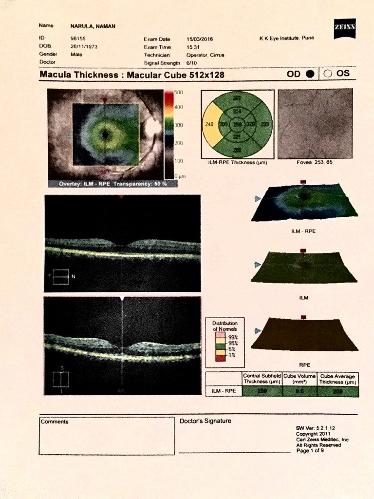 Naman Eye Report | PDF