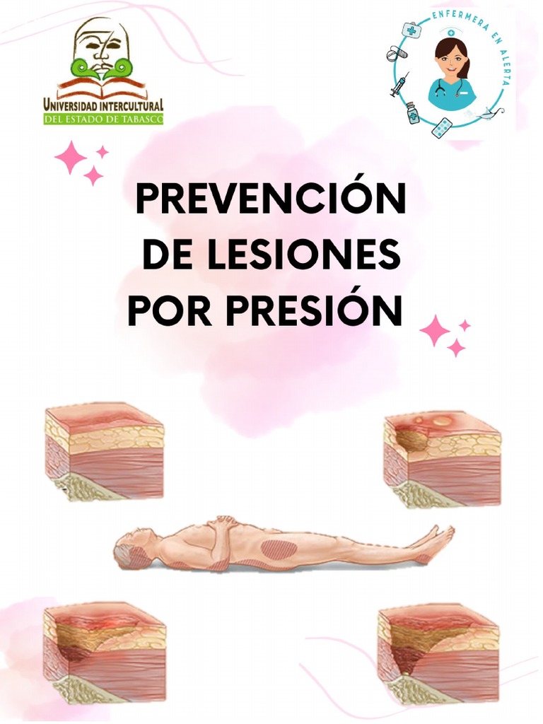 Prevencion de Lesiones Por Presiòn | PDF | Piel | Epidermis