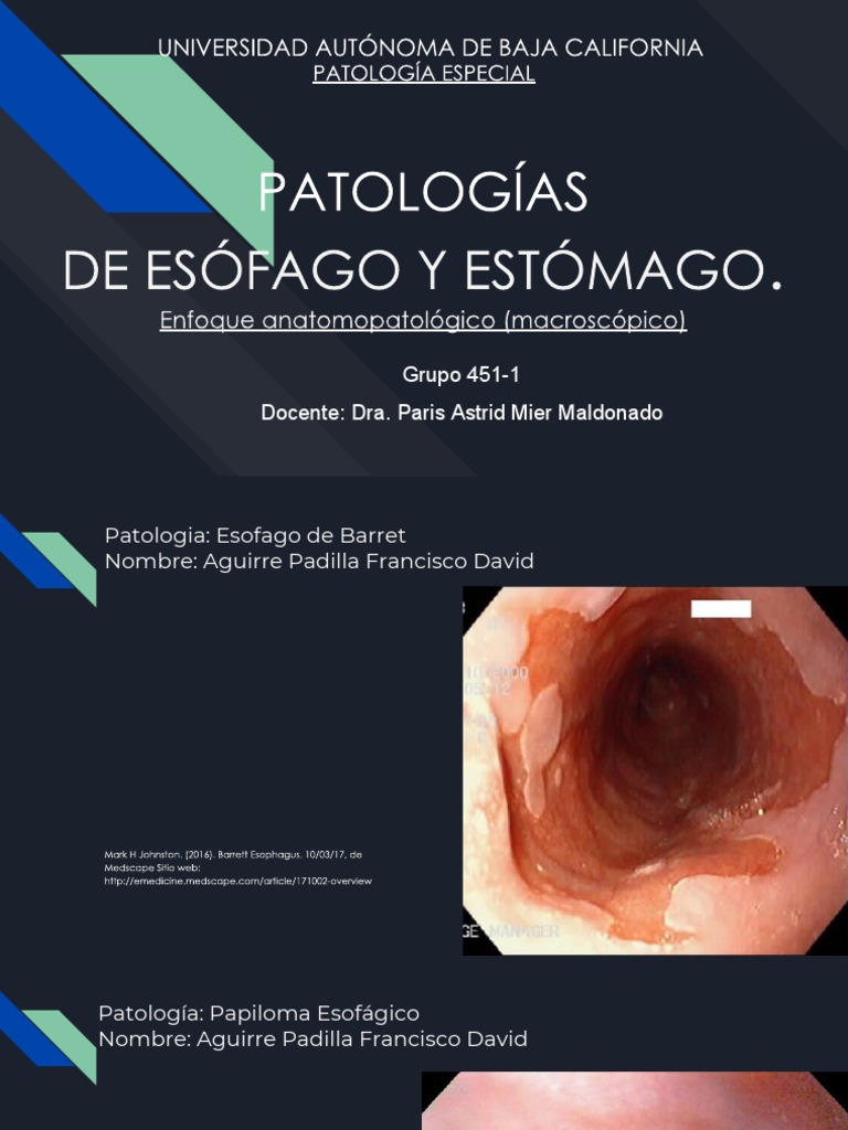 Patologias Del Esofago | PDF