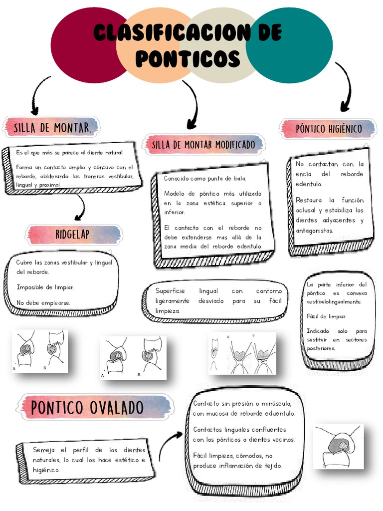 Clasificación de Pónticos Dentales | PDF | Ramas de Odontología