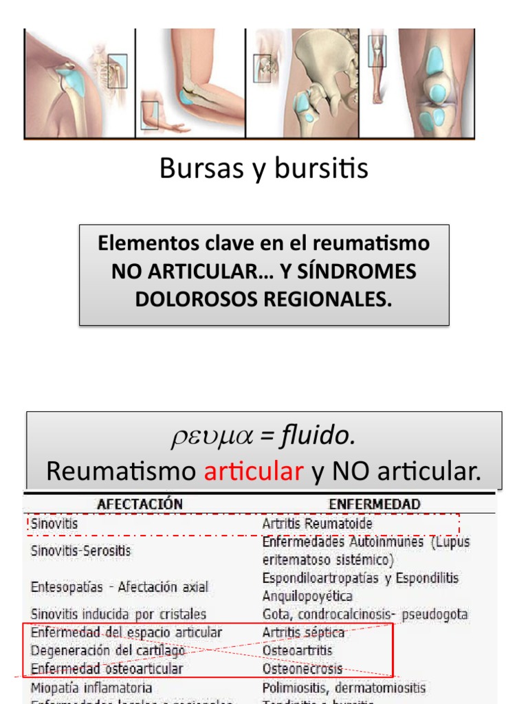 Bursas y Bursitis | PDF
