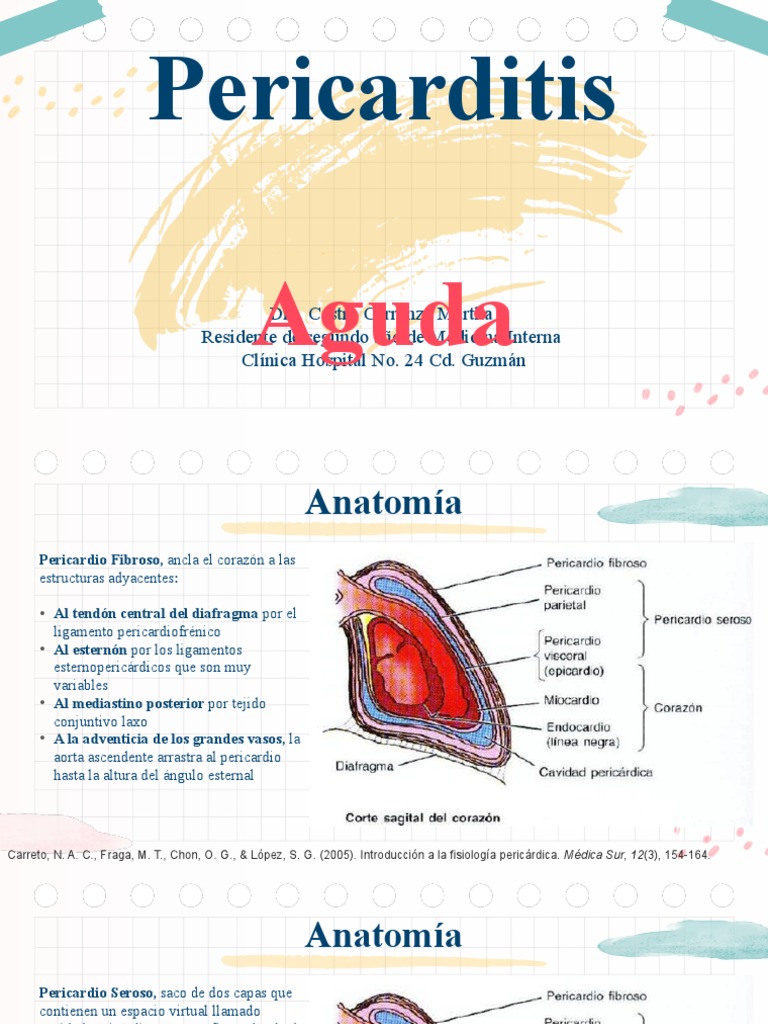 Pericarditis Aguda | PDF