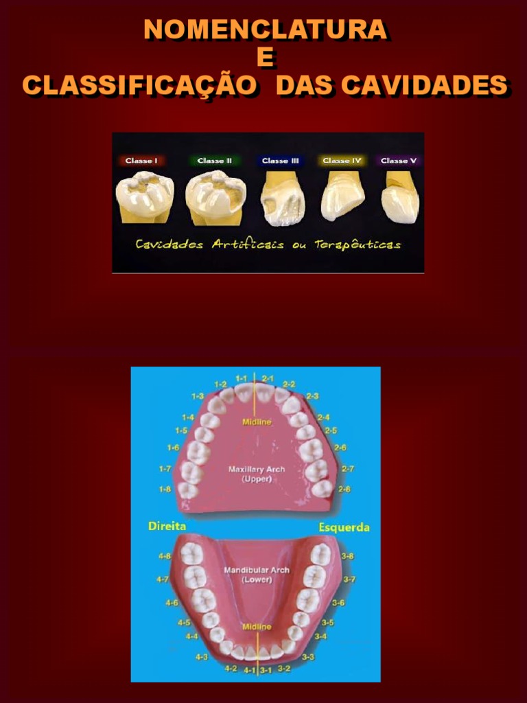 Aula Classificação das Cavidades | PDF | Áreas da odontologia | Boca