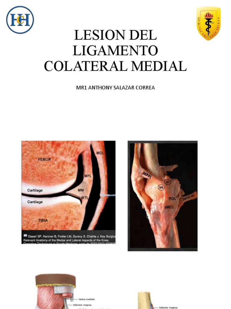 Ligamento Colateral Medial | PDF