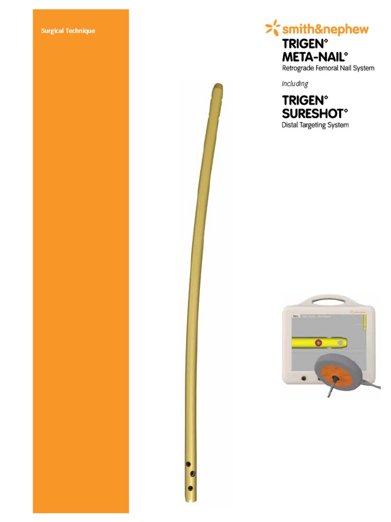 NL Trigen Meta Nail Retrograde Surgicaltechnique | PDF | Electrical ...