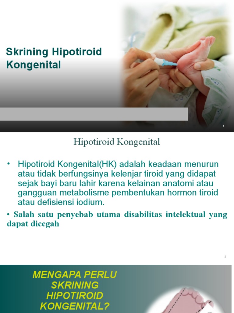 Skrining Hipotiroid Kongenital | PDF