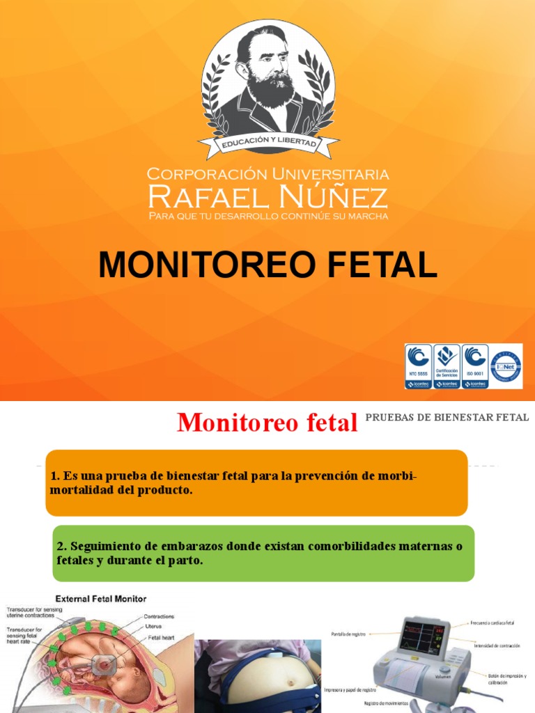 Monitoreo Fetal | PDF