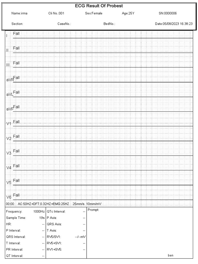 Fall I Fall II Fall III Fall aVR Fall aVL Fall aVF Fall V1 Fall V2 Fall ...