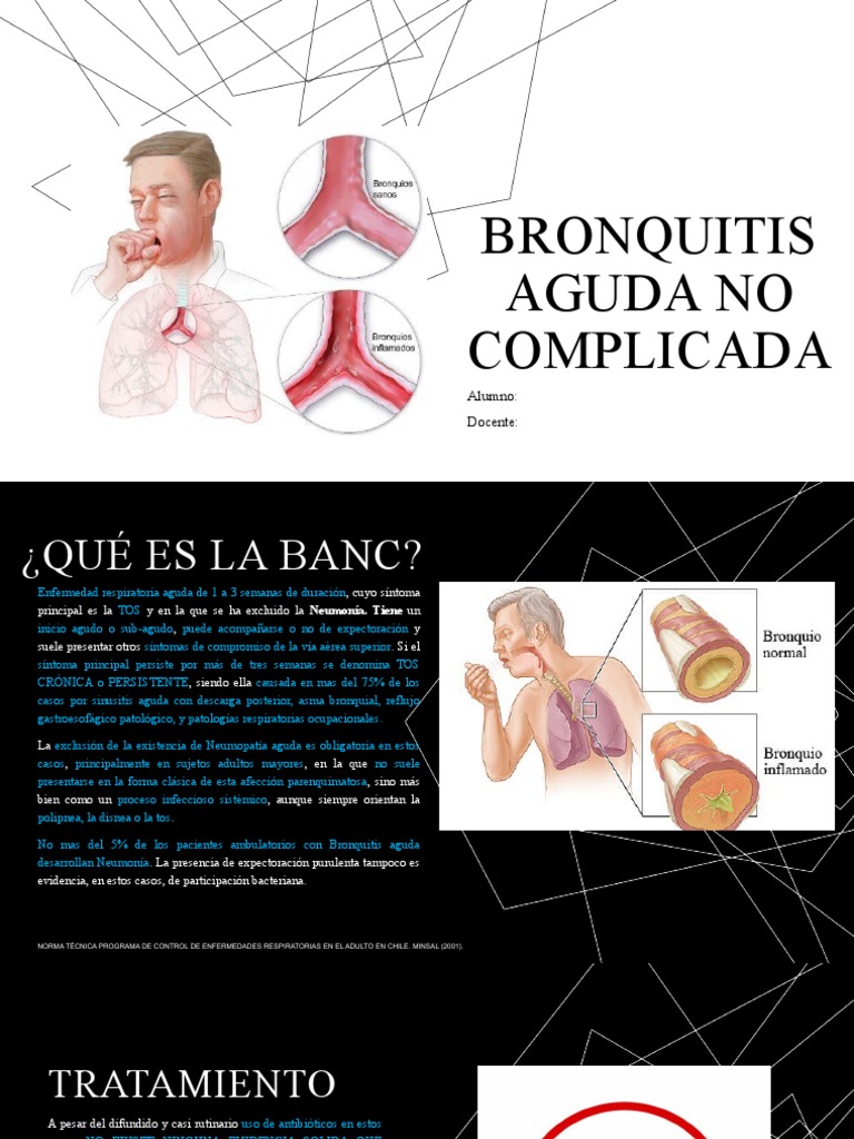 Bronquitis Aguda No Complicada | PDF | Ciencia y matemáticas