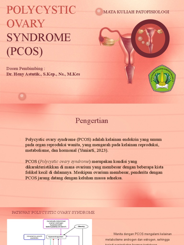 Kel 2 - Polycystic Ovary Syndrome (PCOS) | PDF