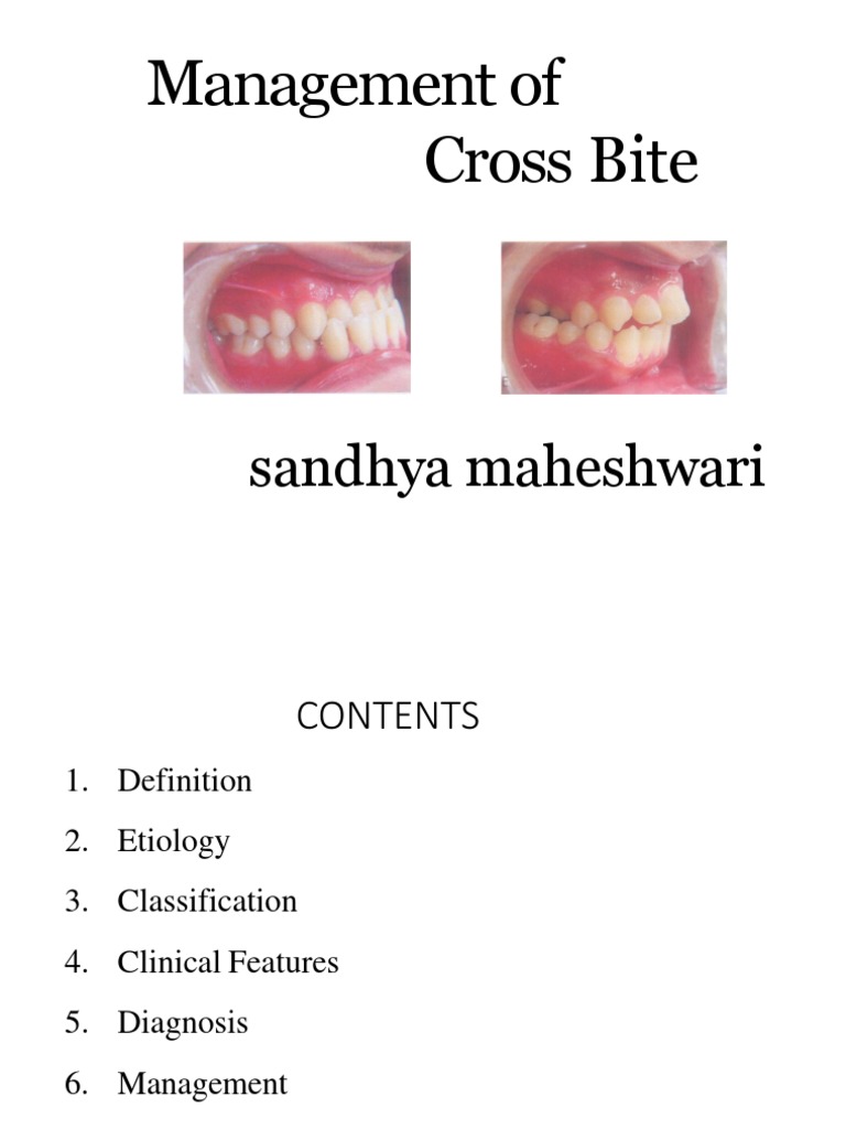 Cross Bite Management Overview | PDF