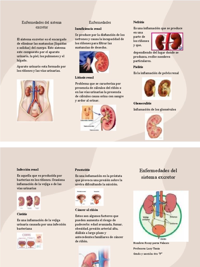 Enfermedades Del Sistema Excretor (Triptico) | PDF
