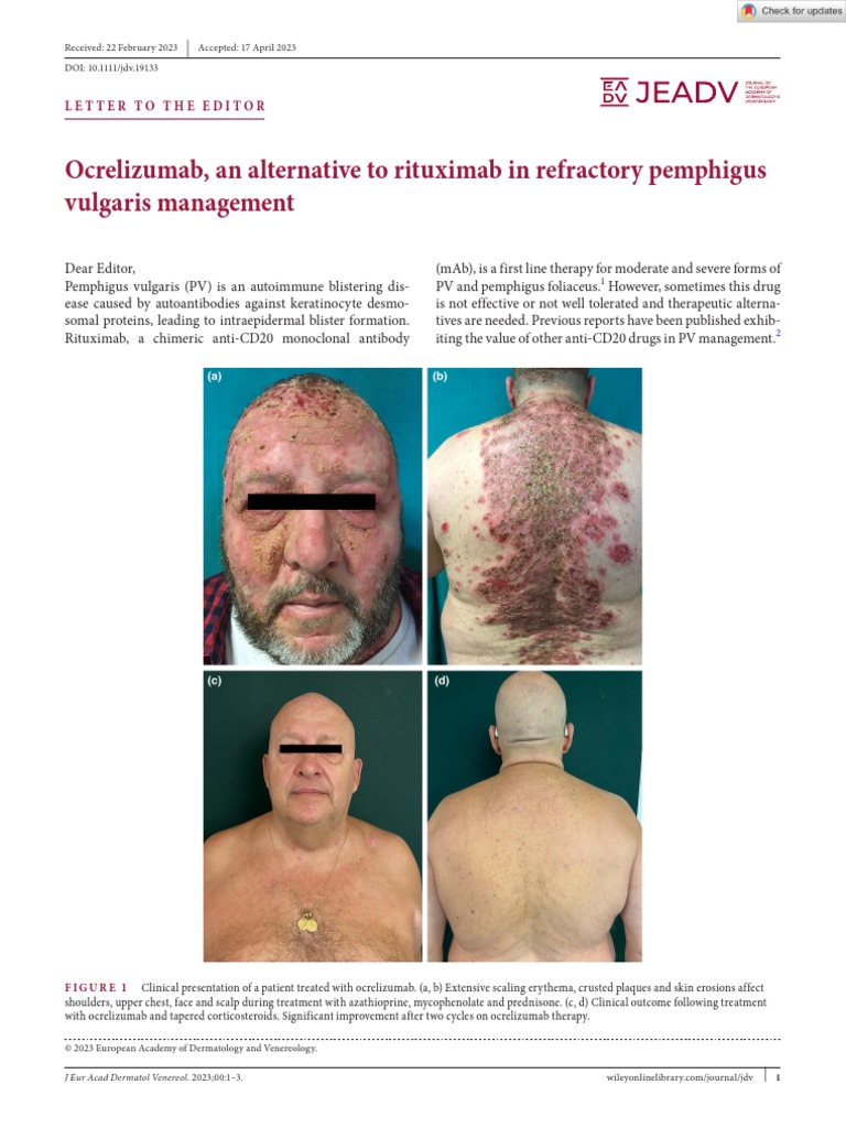 Acad Dermatol Venereol - 2023 - de La Rosa Fern Ndez - Ocrelizumab An ...