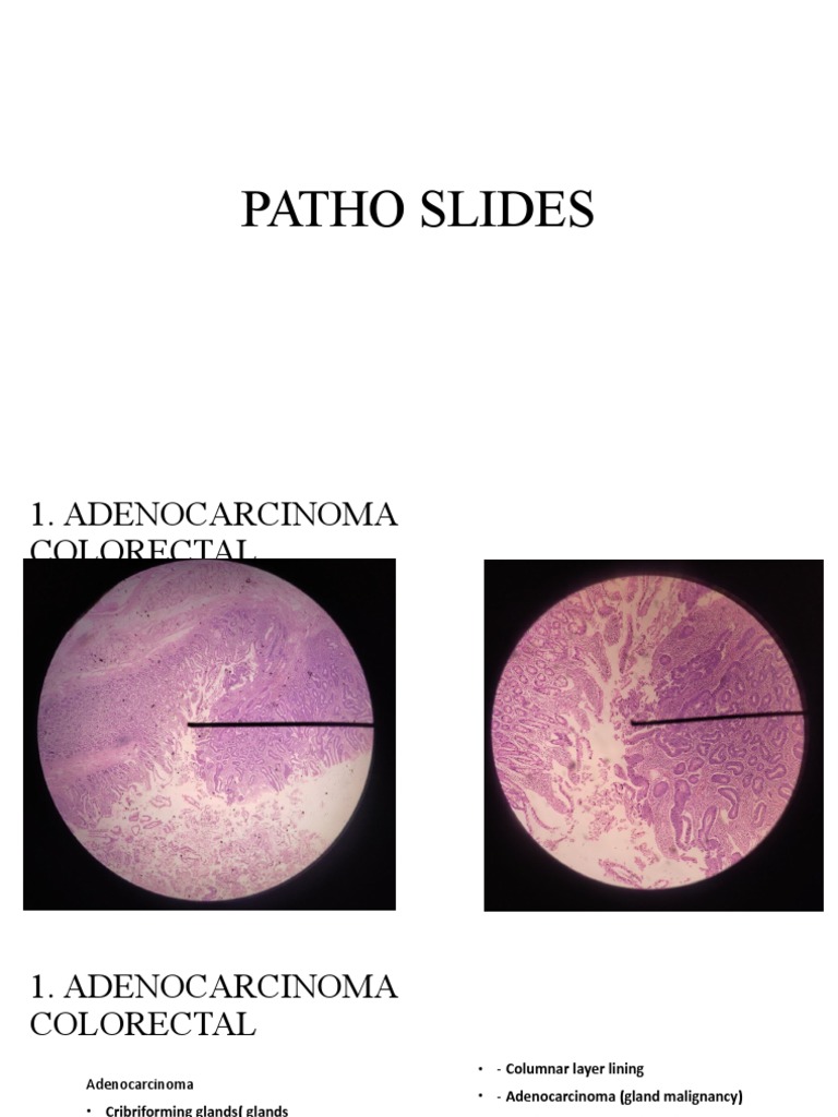 Patho Slides | PDF