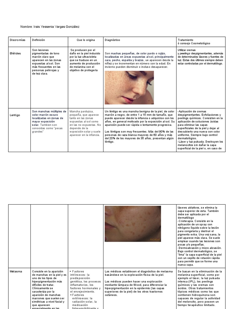 Discromias Tabla 64 A 4 D 5 Da 91 e 5 D | PDF | Piel | Especialidades ...