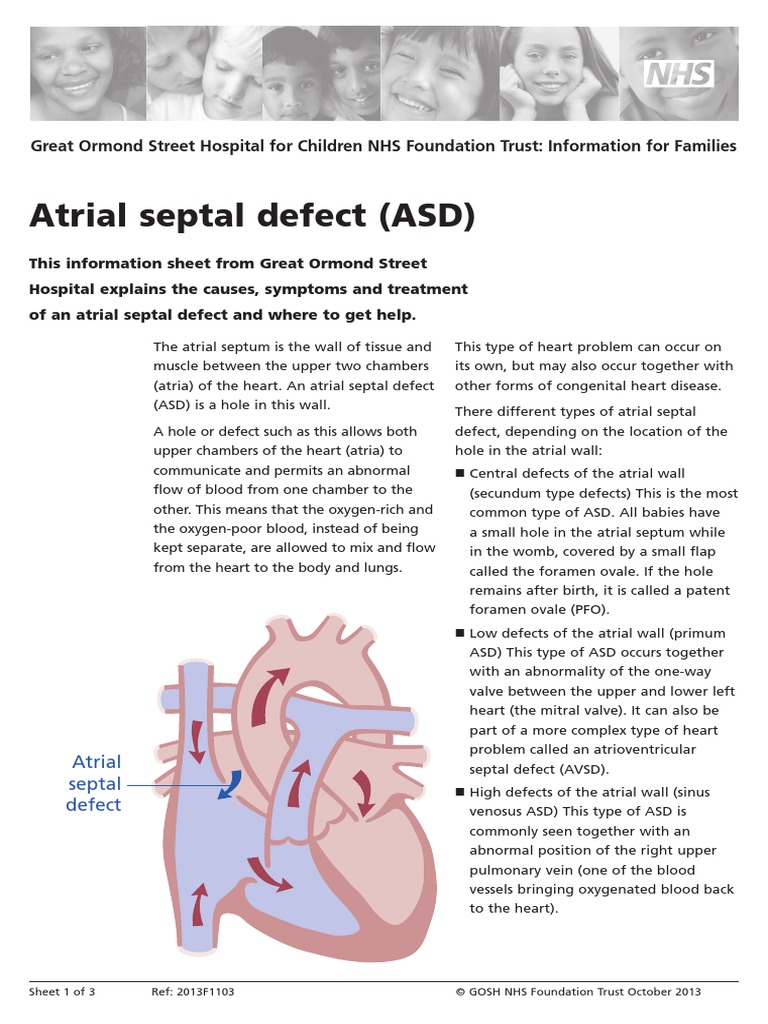 Atrial Septal Defect - GOSH | PDF