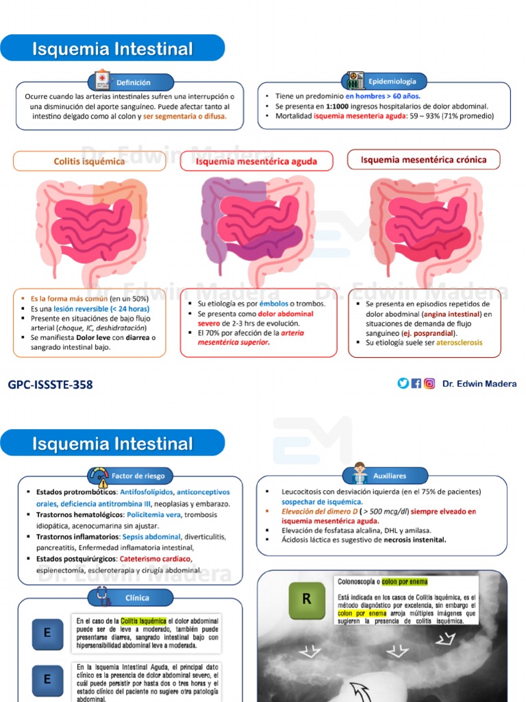 Isquemia Intestinal | PDF