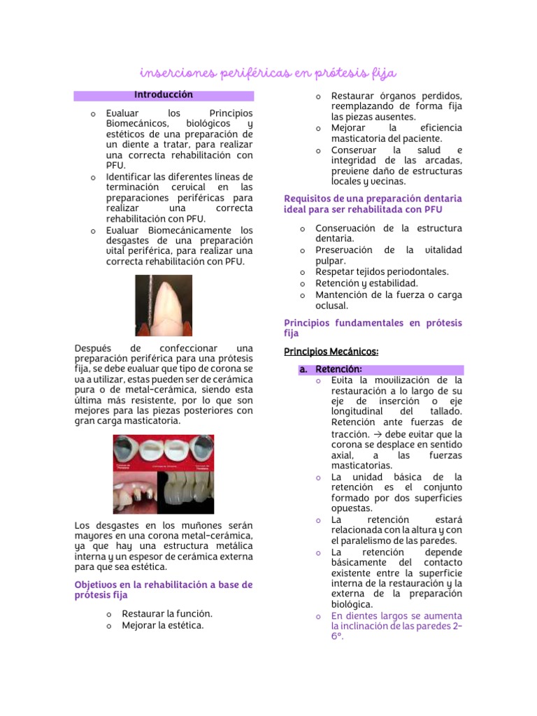 Inserciones Periféricas en Prótesis Fija | PDF | Dentadura postiza