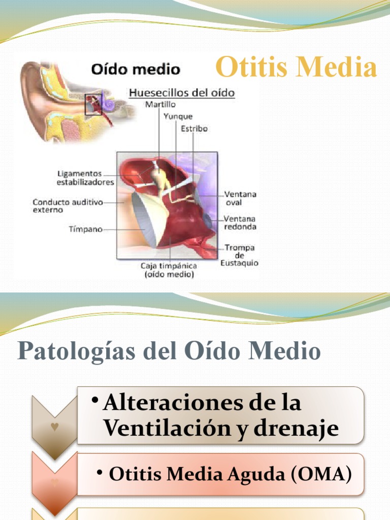 Otitis Media Copiar | PDF