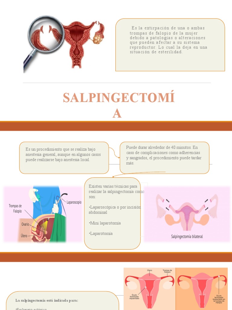 Salpingectomía: Procedimiento y Riesgos | PDF | Control de la natalidad ...