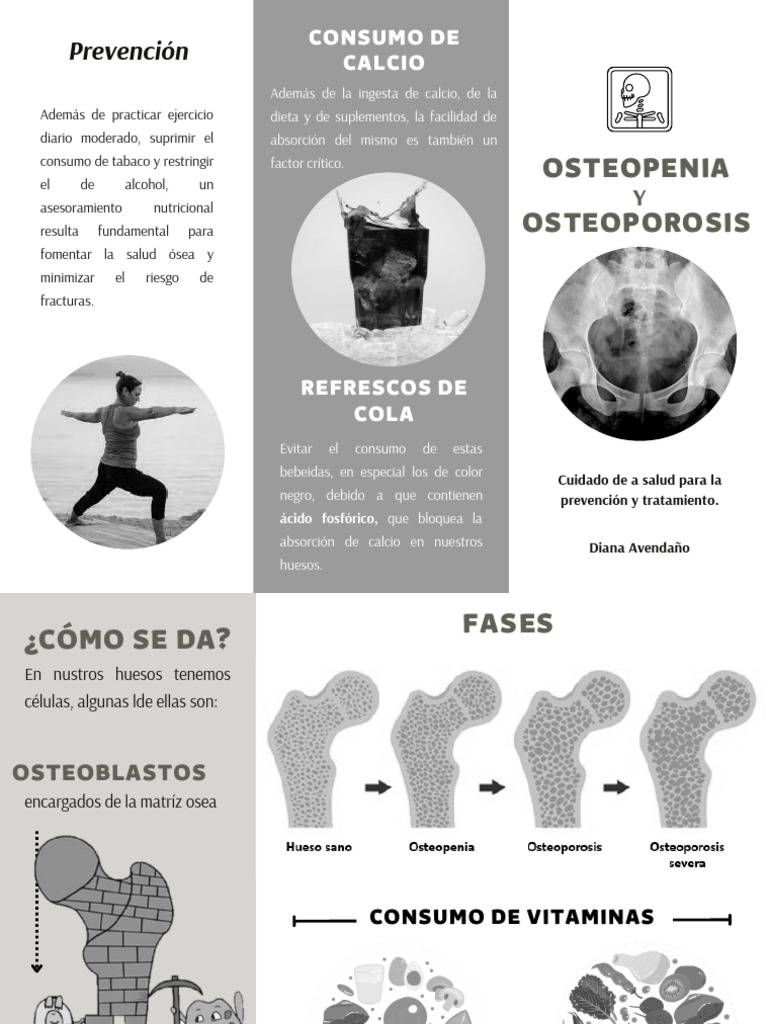 Folleto Osteopenia y Osteoporosis | PDF